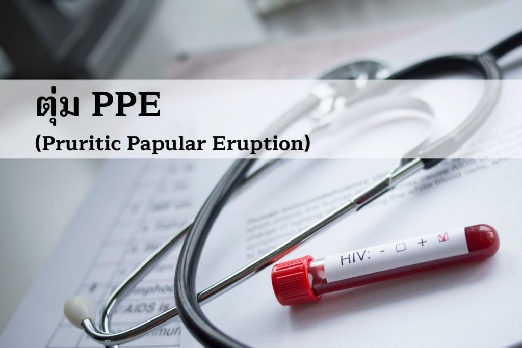 ตุ่ม PPE (Pruritic Papular Eruption) : HIV Thailand